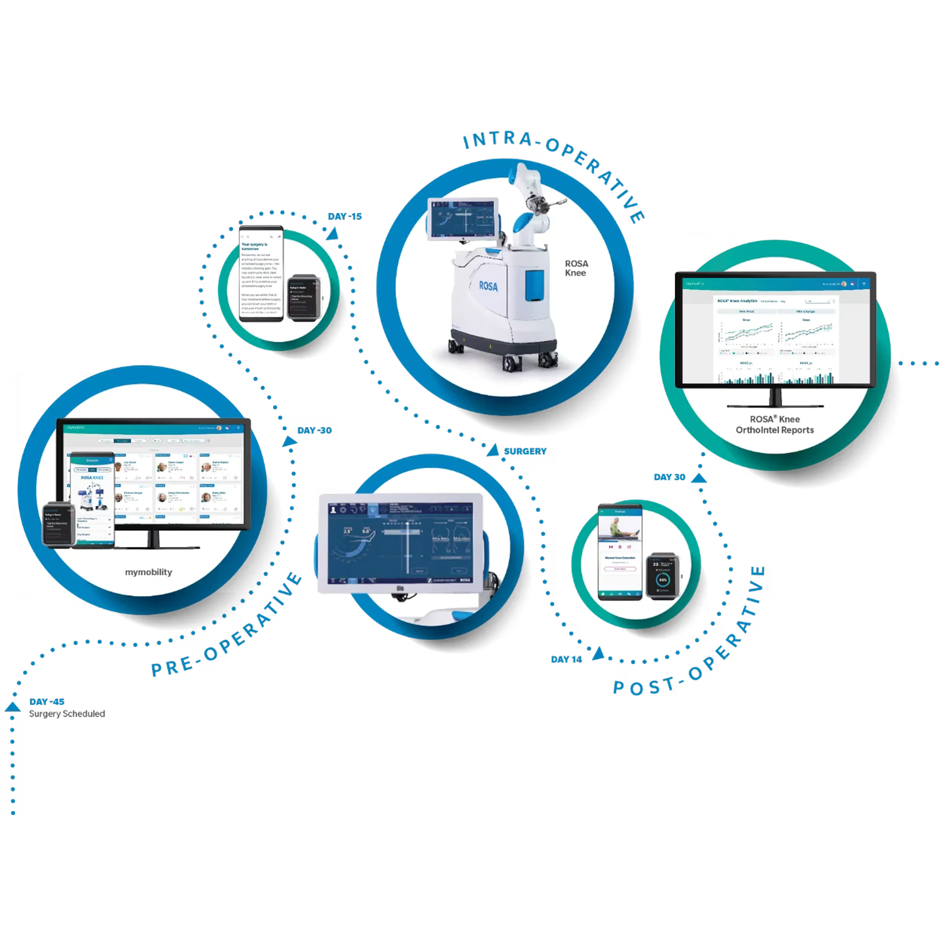 Orthointel | Zimmer Biomet | Zimmer Biomet