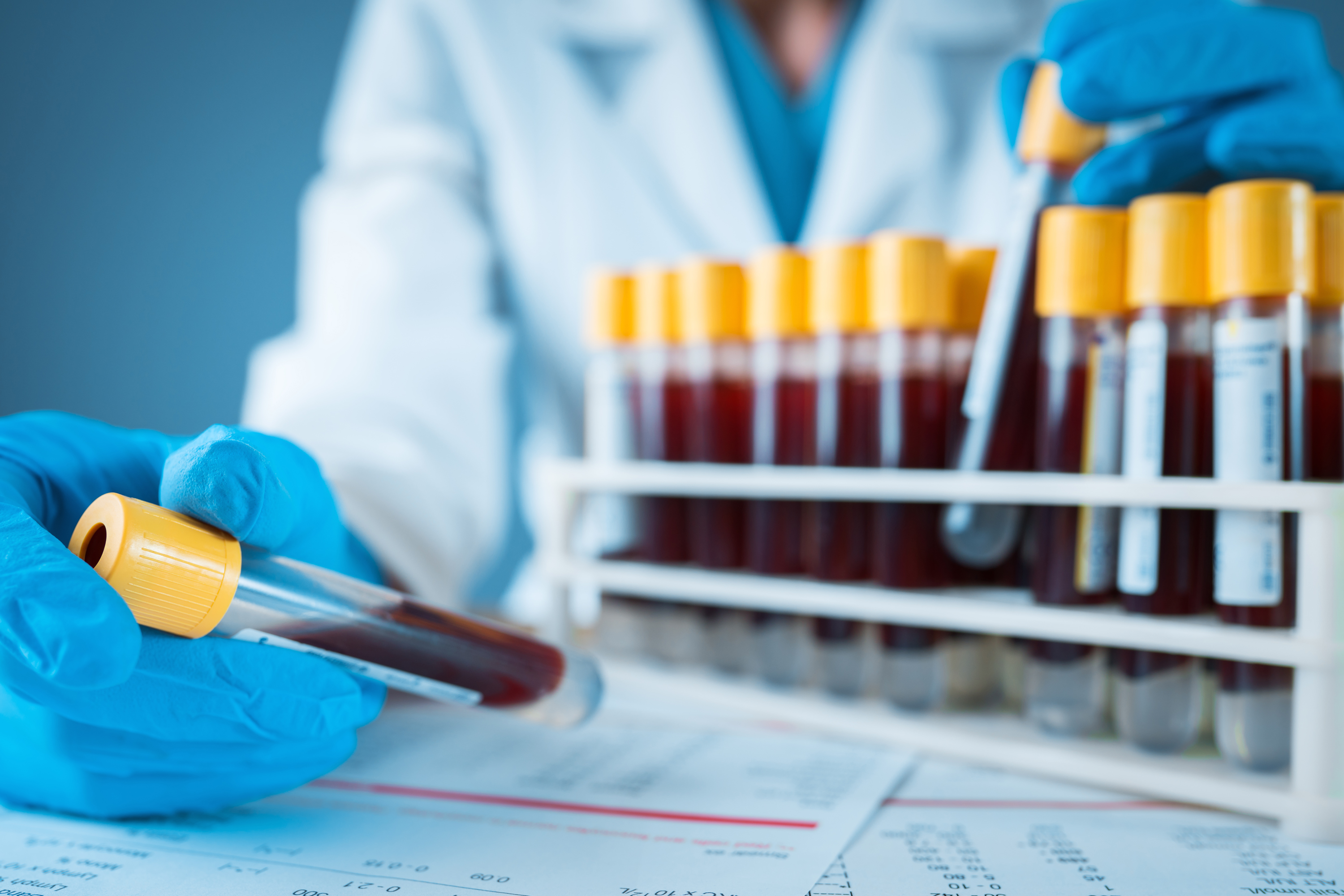 Experts Say a Mildly Detectable Viral Load Can’t Transmit HIV and May ...