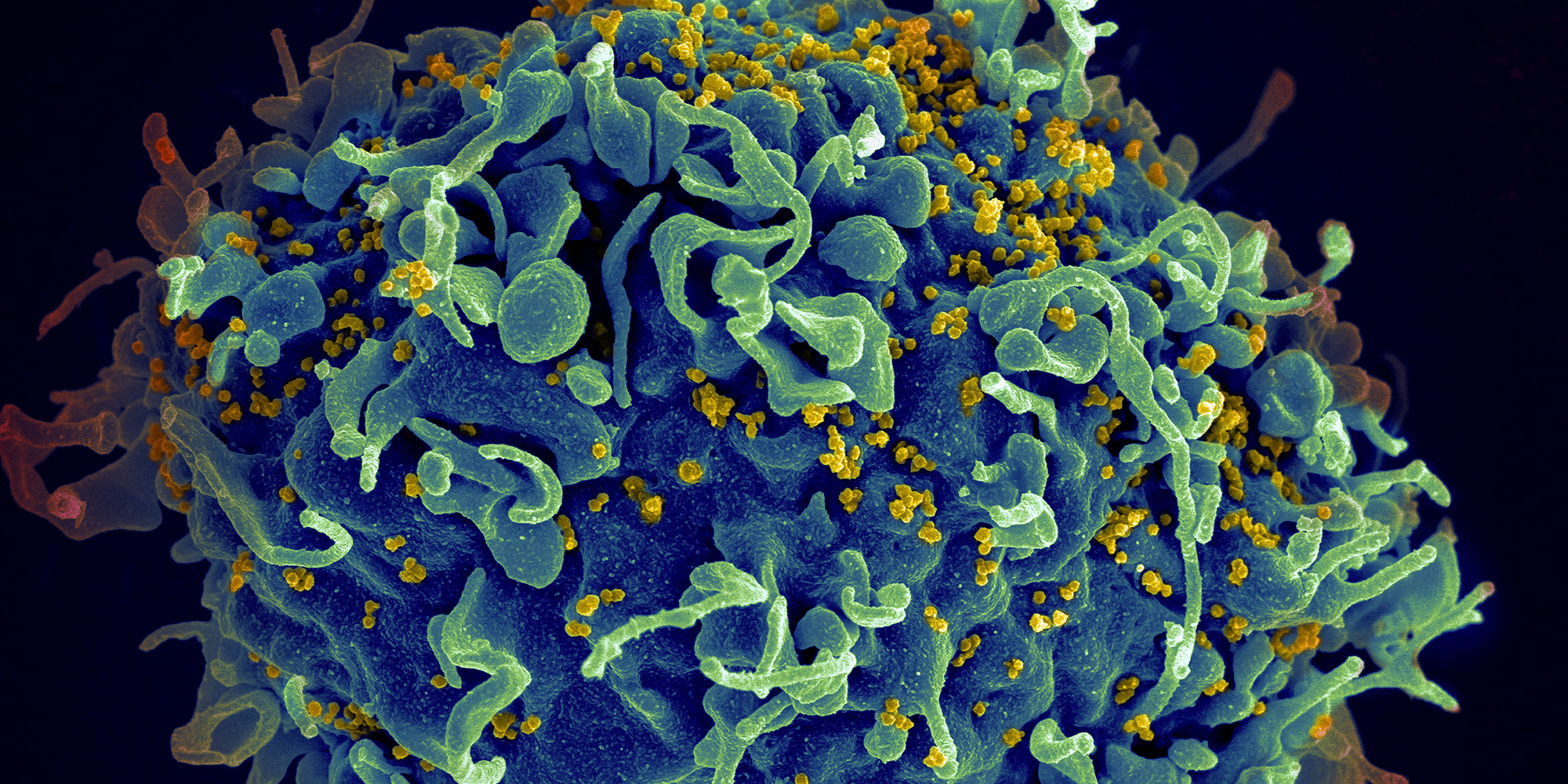 Aids Virus Electron Microscope