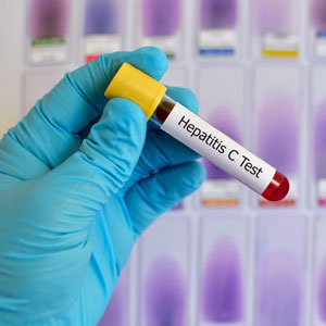 Hepatitis C: Frequently Asked Questions