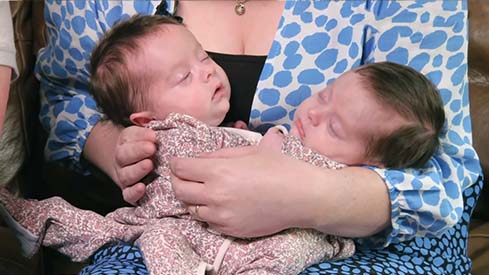 Meet the 'miracle' conjoined twins | This Morning
