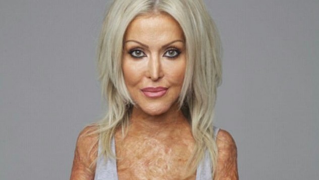 BURNT ALIVE: She got 17 years but I'm the one with a life sentence ...