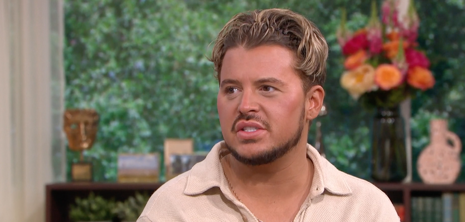 The dangerous fox eye facelift trend | This Morning