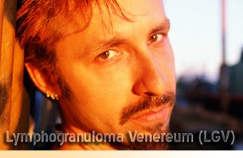 Lymphogranuloma Venereum Bacteria