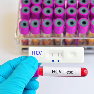 HCV Cure and the Long Road to Recovery