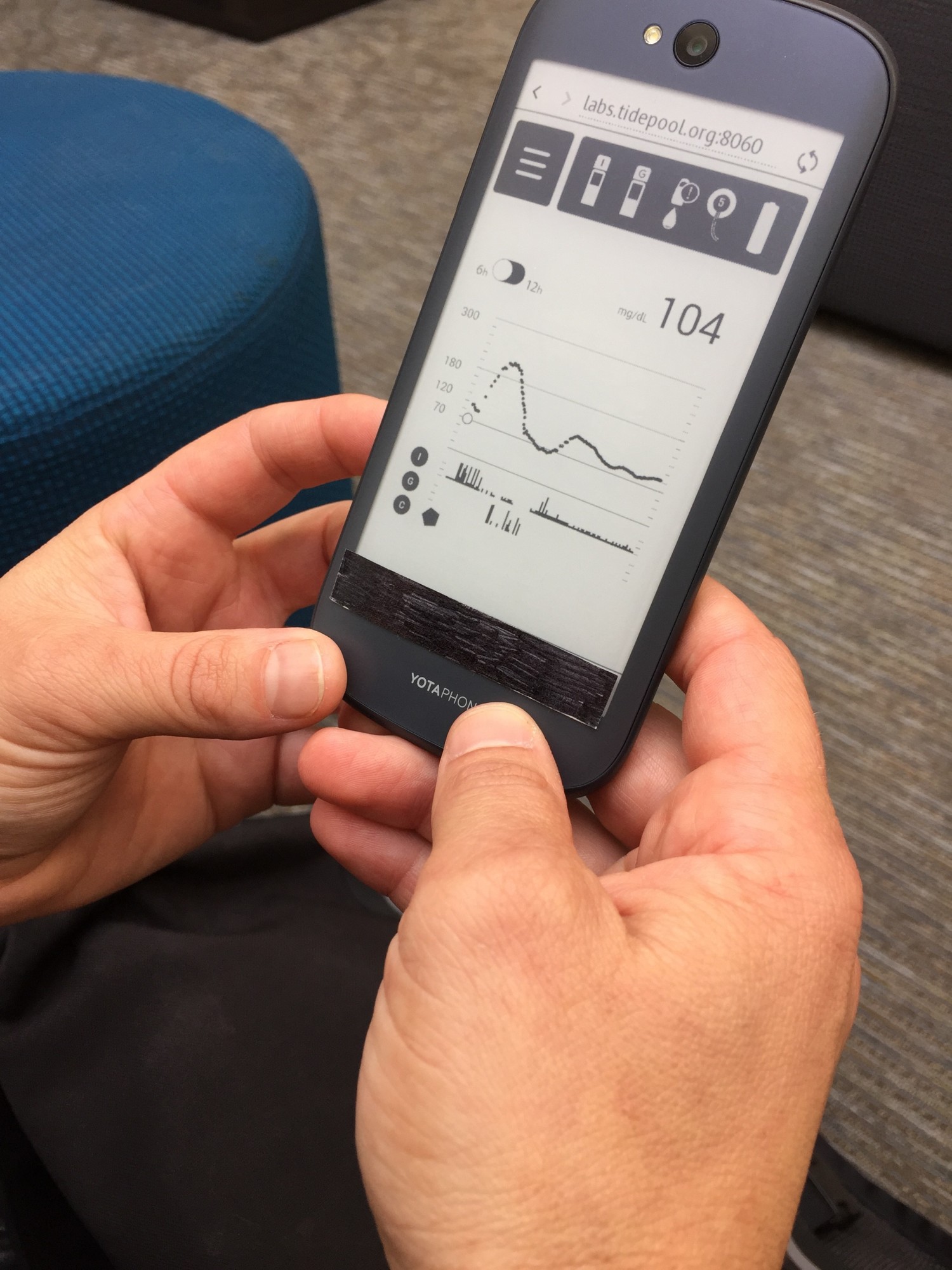 Bionic Pancreas user interface pt. 4 | Tidepool