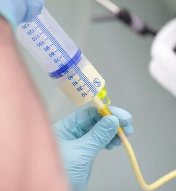 Ga je sondevoeding toedienen? Let op deze 4 punten!