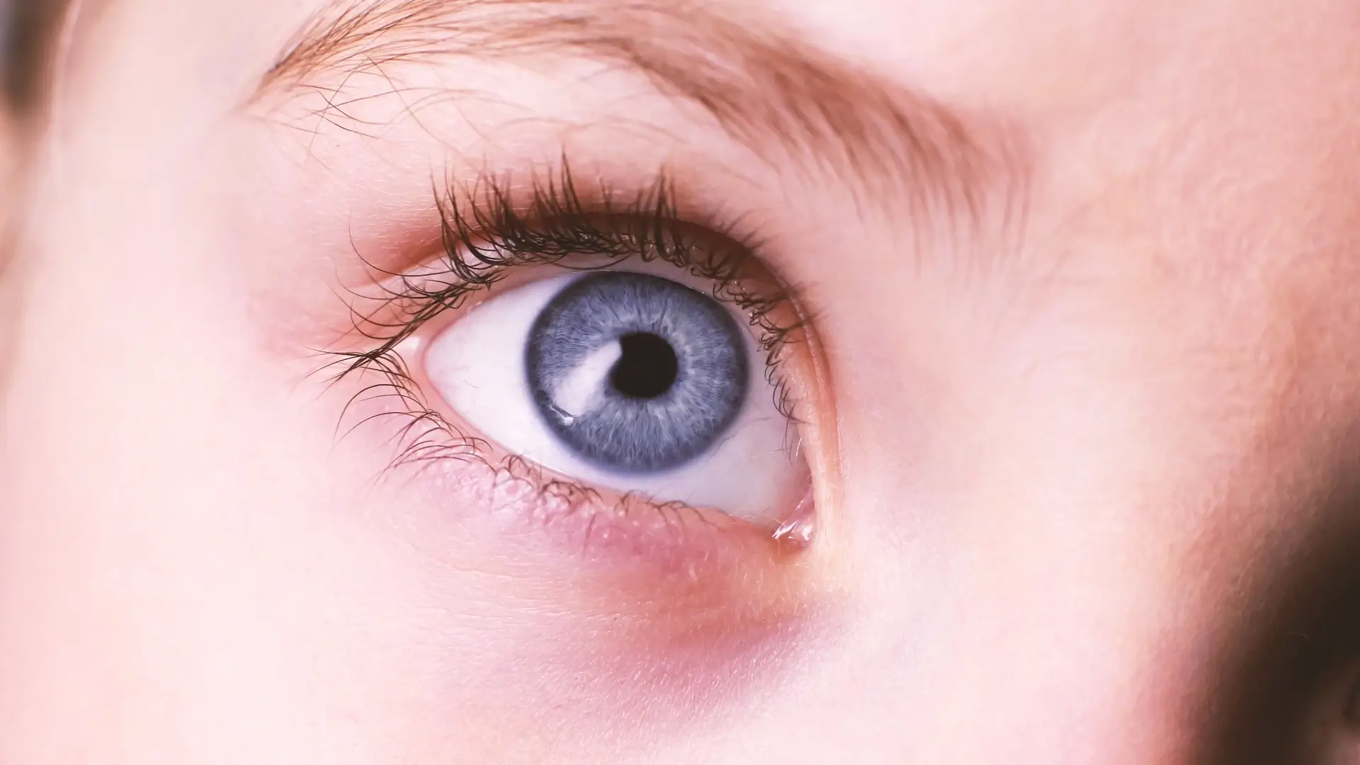 Eye Allergies (Allergic Conjunctivitis): Causes & Symptoms | BENADRYL®
