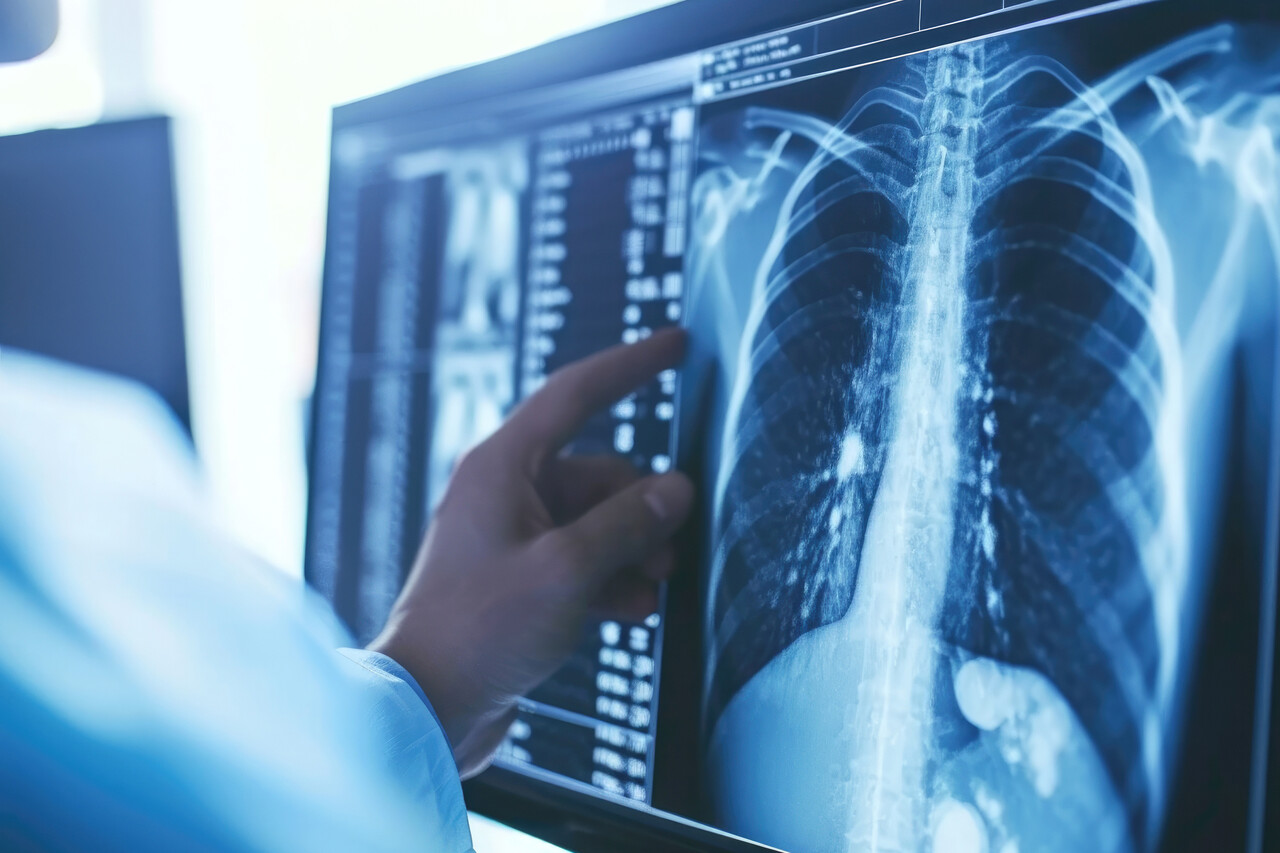 Warning Issued Over Serious Safety Concern for Pralsetinib (Gavreto) in ...