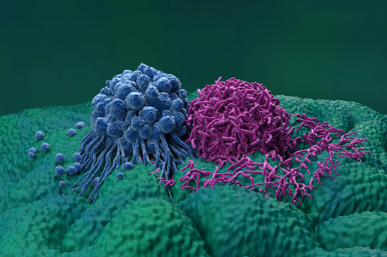 FDA Approves Pembro Plus Chemo in HER2-Negative Gastric or ...