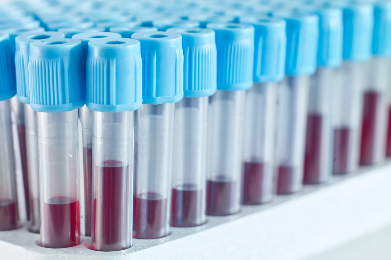 MRD Remains a Mixed Bag in Blood Cancer Care