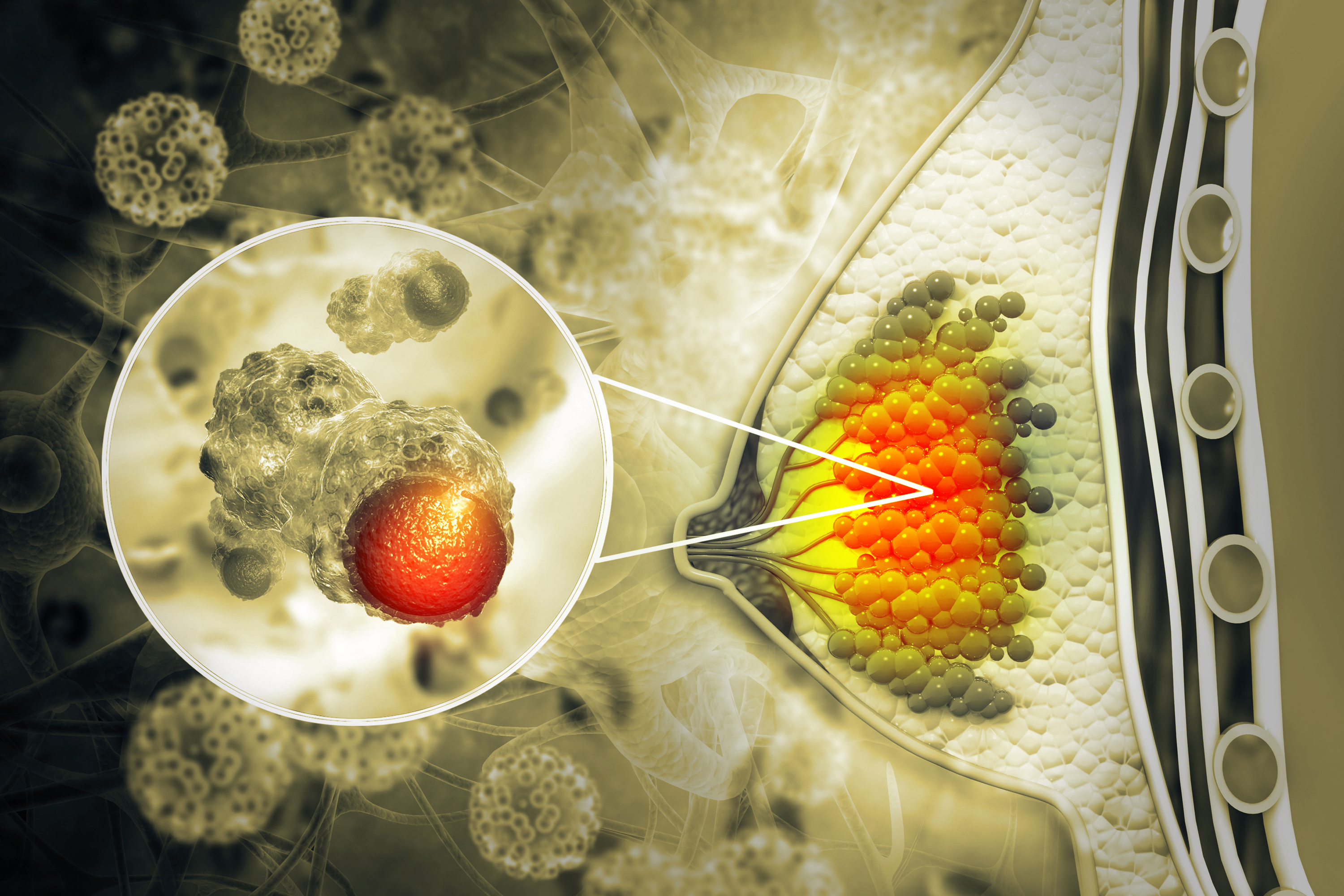 Trastuzumab Deruxtecan (Enhertu) Beats Chemotherapy in PFS for HER2-Low ...