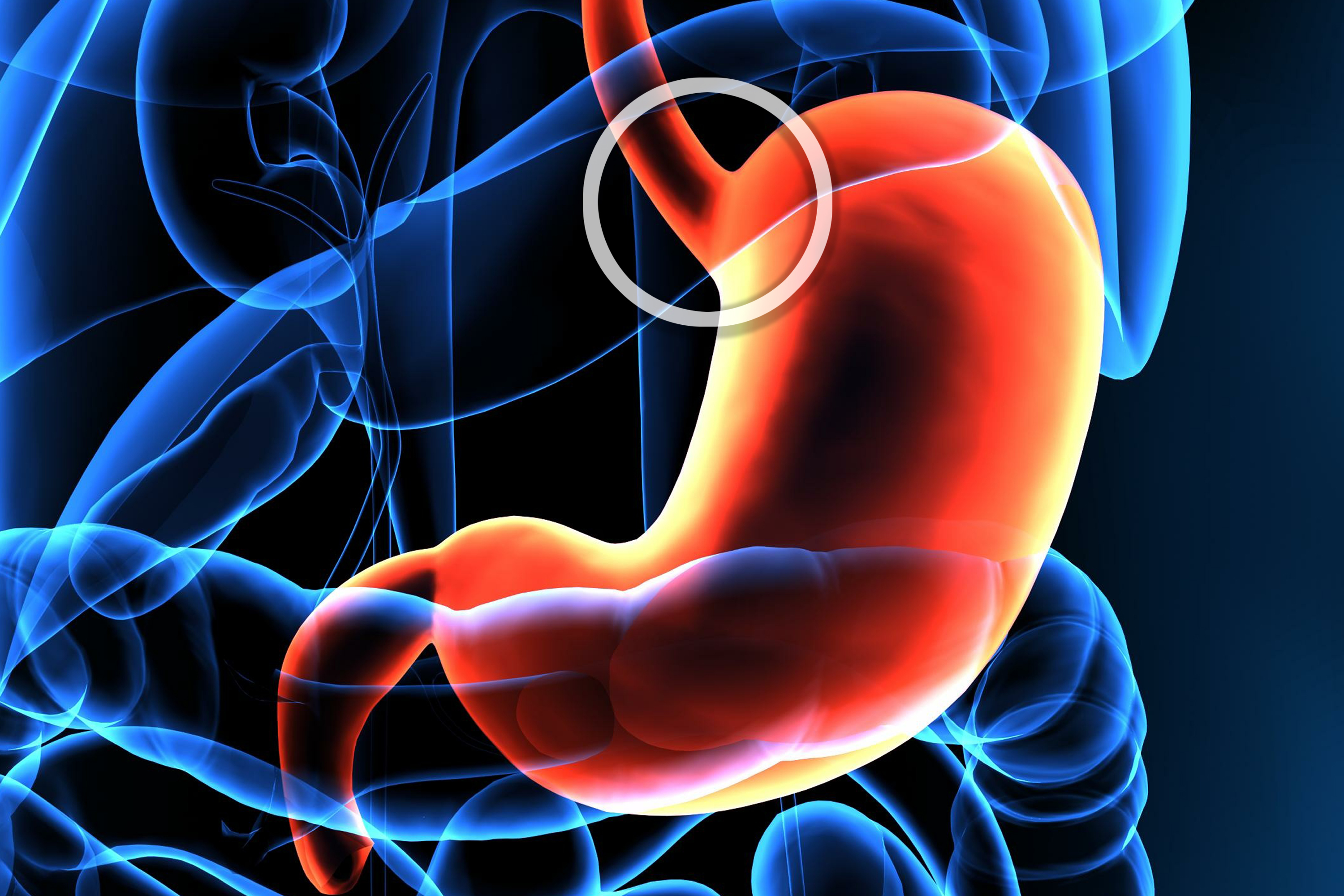 FDA Approves Tislelizumab-jsgr (Tevimbra) Combo for Gastric or ...