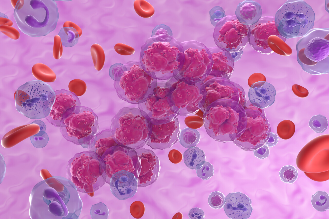 FDA Approves Blinatumomab for Consolidation in Some B-cell Acute ...
