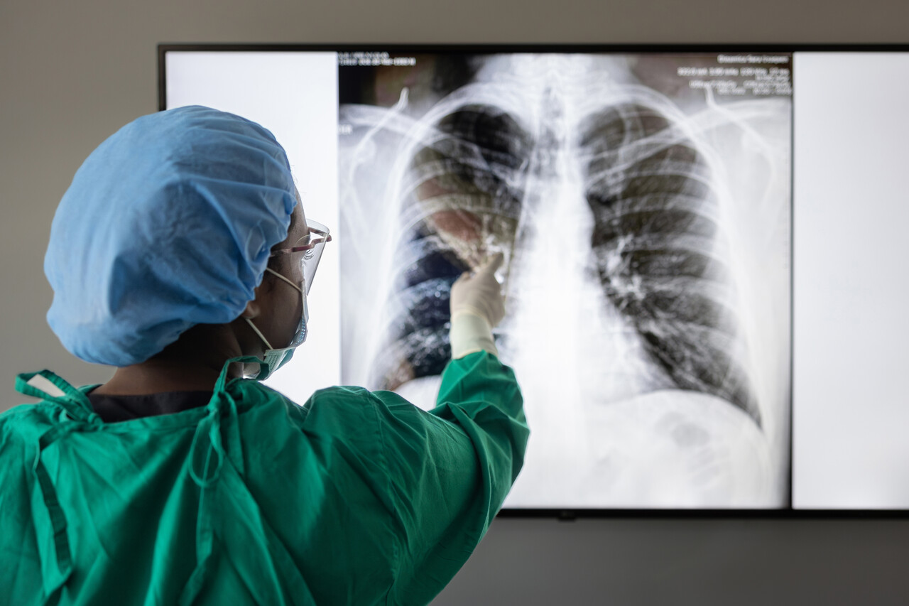 Frontline Drug Combo Boosts PFS in EGFR-Mutated NSCLC Trial, OS Data ...