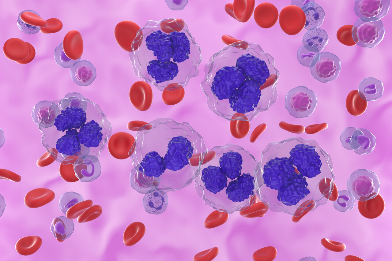 FDA Approves Tafasitamab (Monjuvi) Combination for Follicular Lymphoma