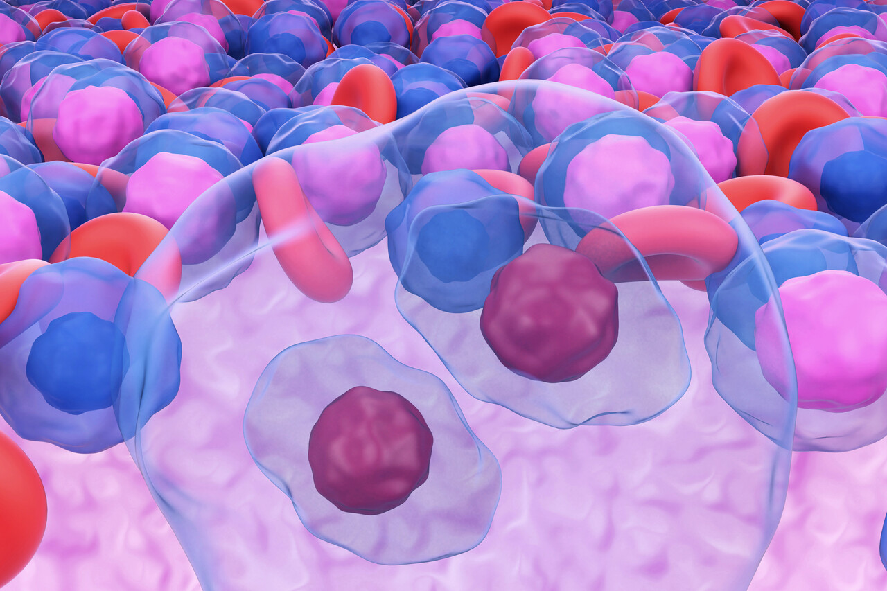 Nivolumab Bests Brentuximab Vedotin in Treatment-Naïve Hodgkin Lymphoma
