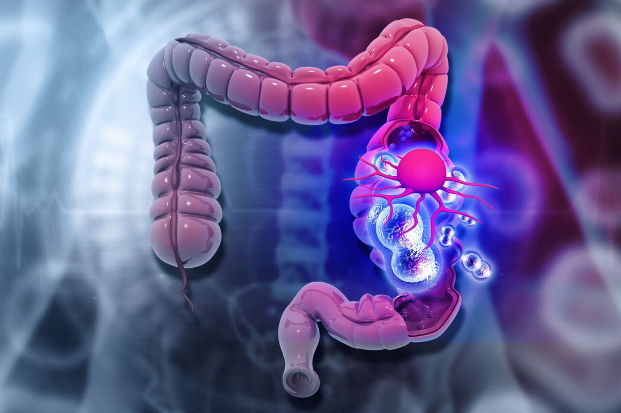 FDA Approves Encorafenib (Braftovi) Combination for Metastatic ...