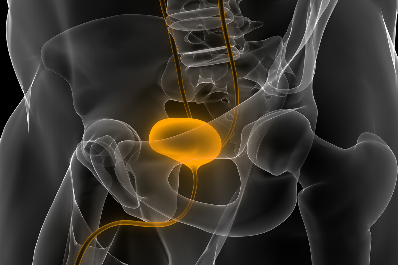 Avelumab Shows Survival Benefit in Bladder Cancer, Regardless of Diabetes