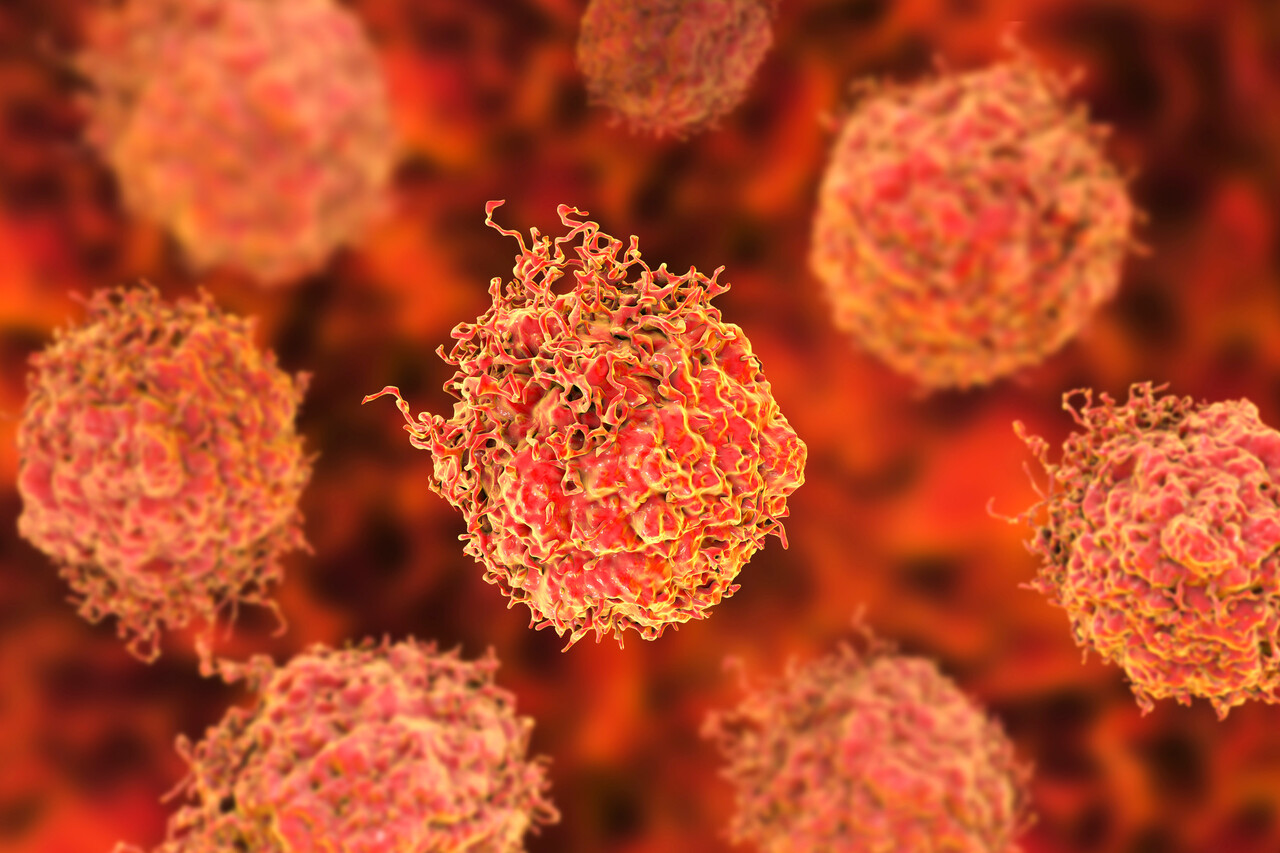 First New Treatment Paradigm in Localized Prostate Cancer in 20 Years?