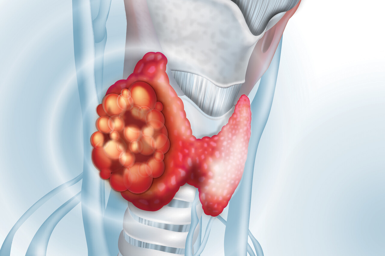 FDA Grants Full Approval to Selpercatinib (Retevmo) for RET-Mutant ...