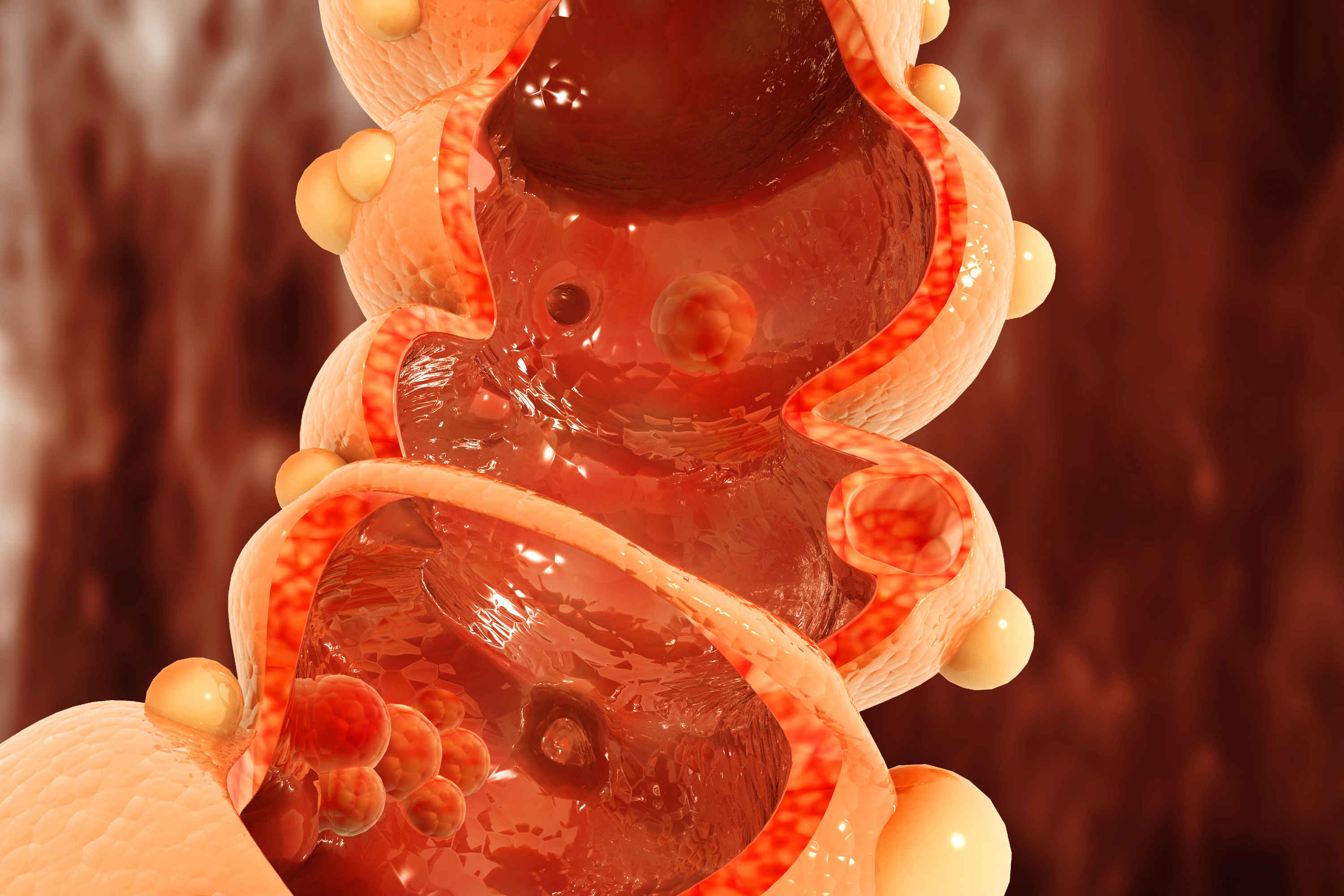 FDA Approves Retifanlimab (Zynyz) for Advanced Anal Cancer