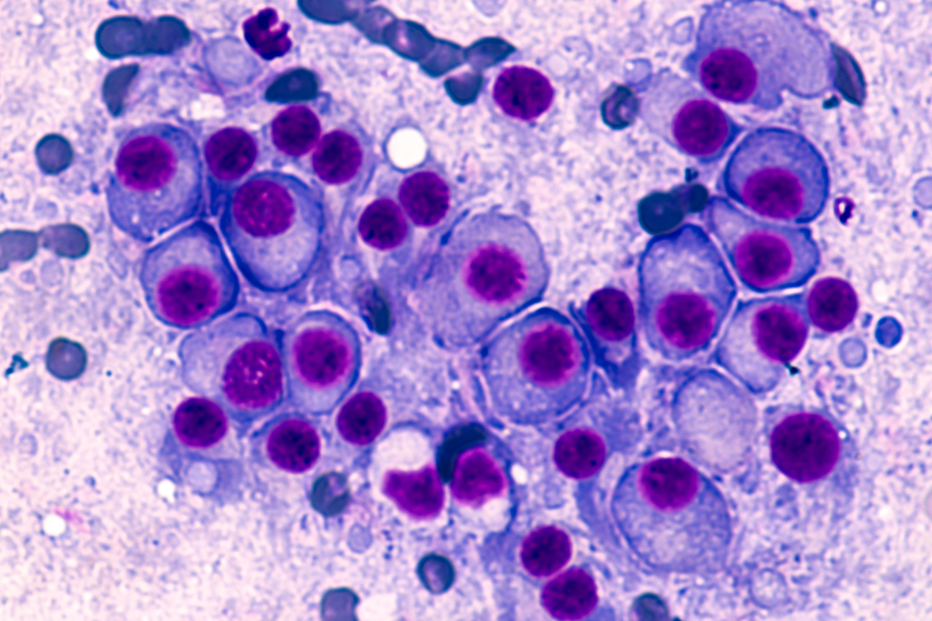 Bispecific Linvoseltamab Yielded Deep, Durable Responses in RRMM in ...