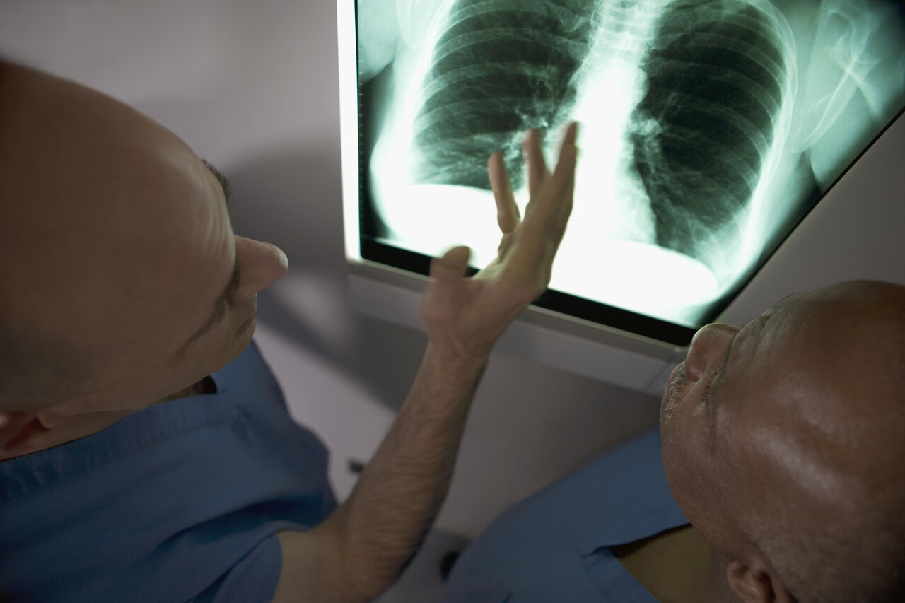 FDA Approves Adjuvant Pembrolizumab (Keytruda) for Non-small Cell Lung ...