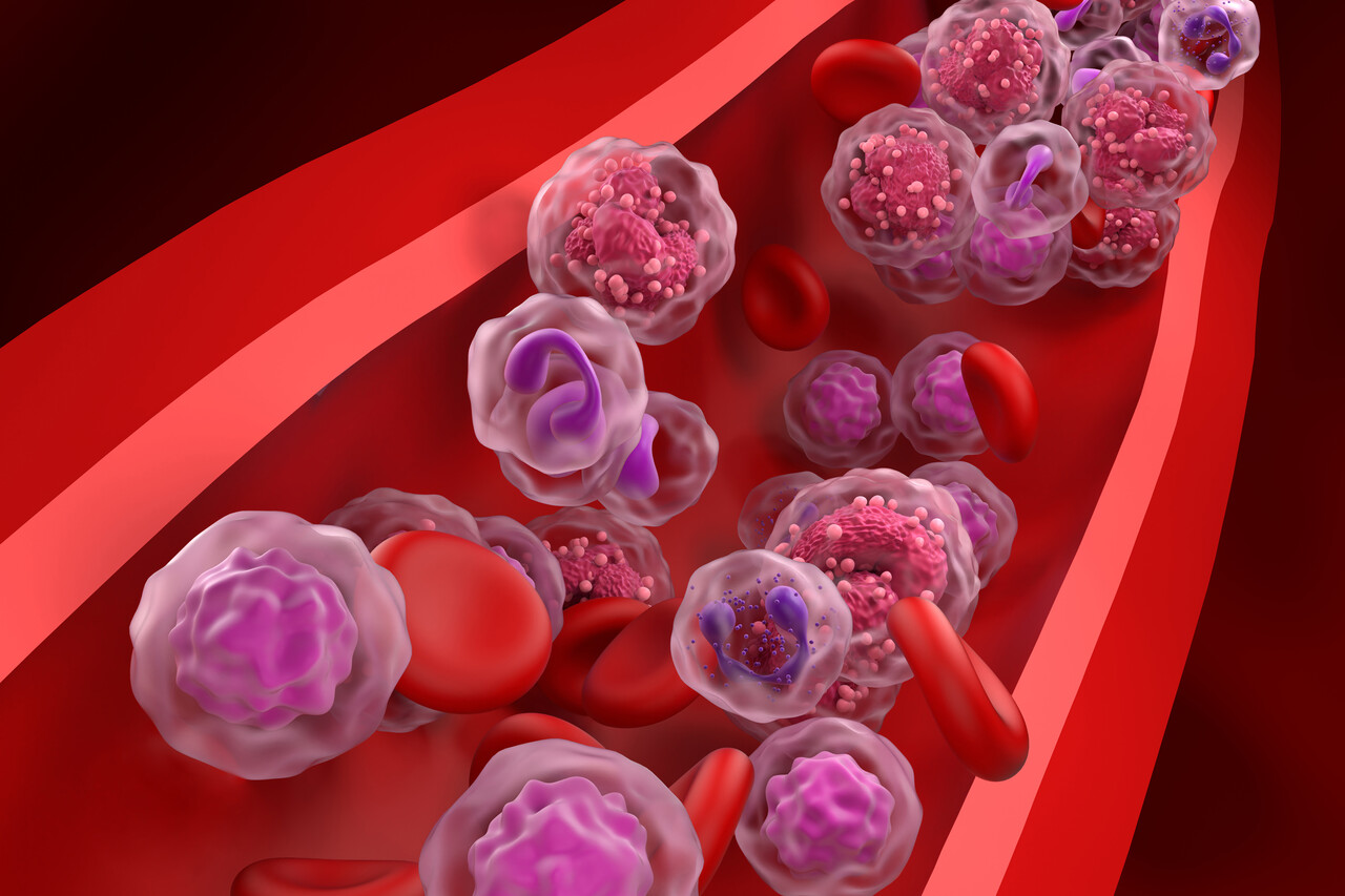 FDA Approves Obecabtagene Autoleucel (Aucatzyl) for Acute Lymphoblastic ...