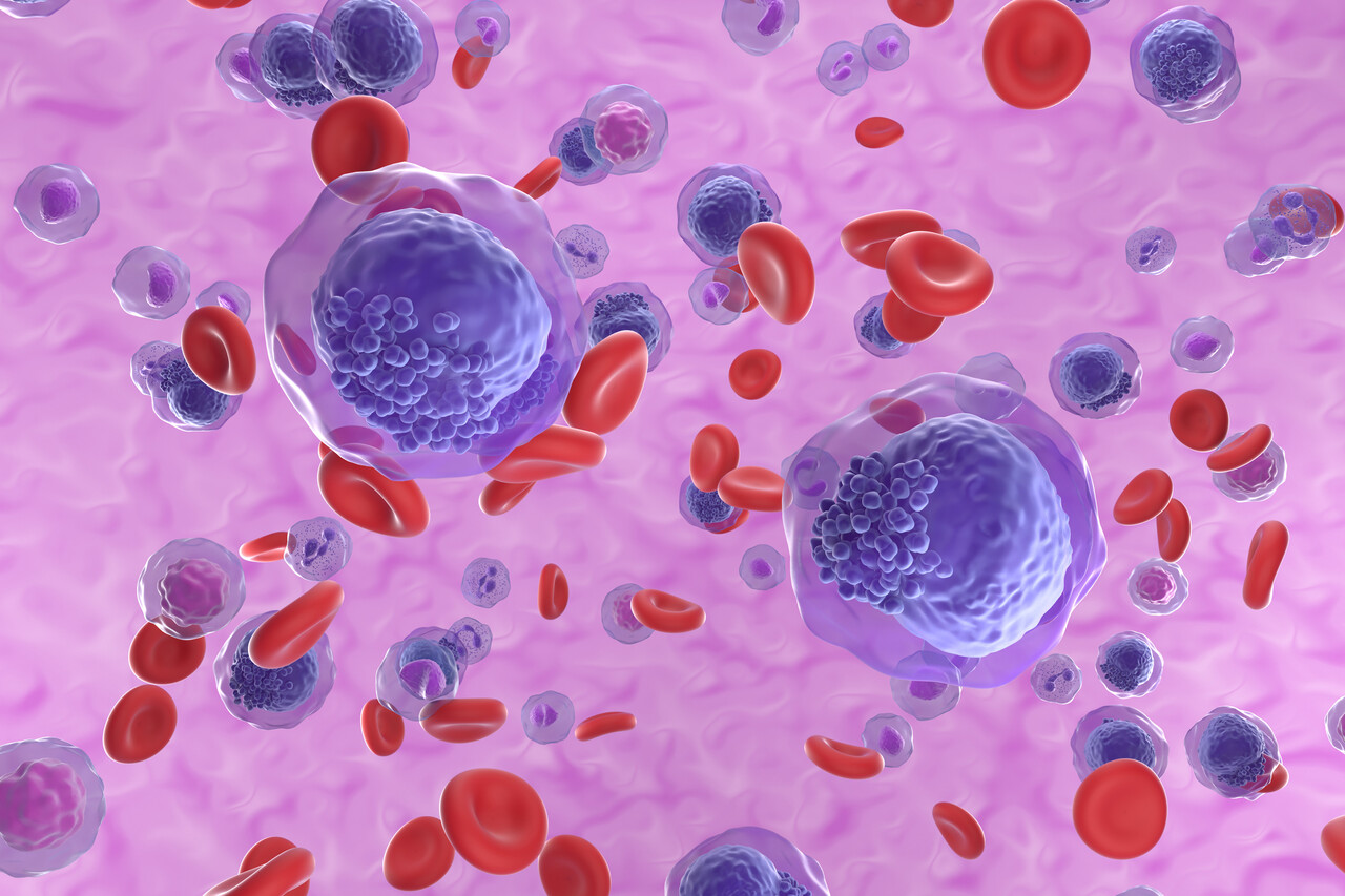 Revumenib Shows “Impressive” Results in R/R Acute Leukemia Trial