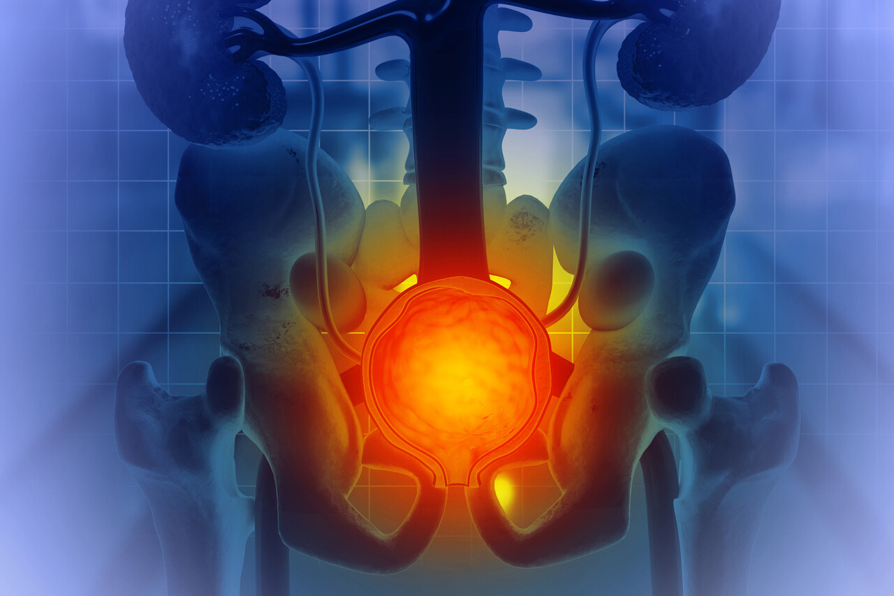 New ADC Poised to Enter Bladder Cancer Care?