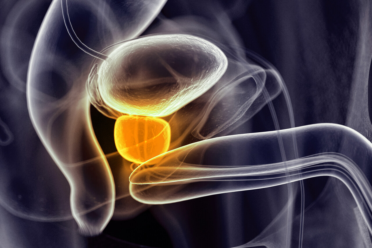 ASCO Issues First Living Guidelines for Prostate Cancer