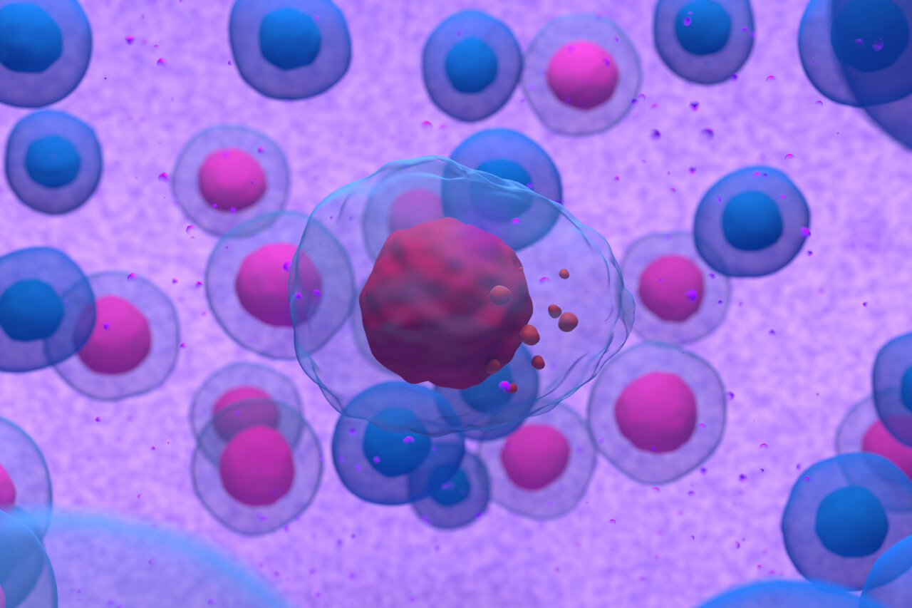 FDA Approves Belantamab Mafodotin Combo for Multiple Myeloma