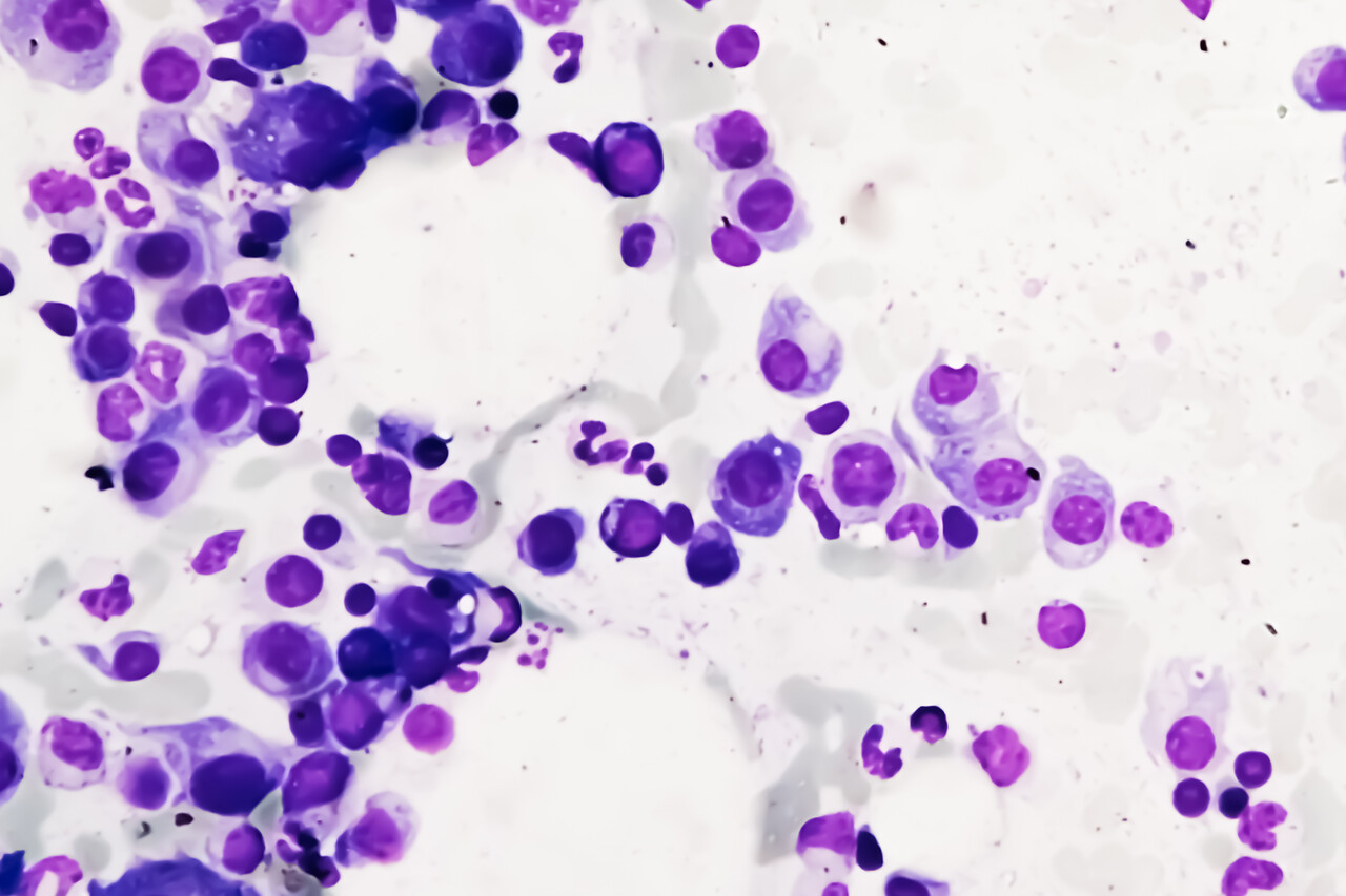 FDA Grants Accelerated Approval for Linvoseltamab for Relapsed Myeloma