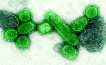 Thermococcus Litoralis Common Name