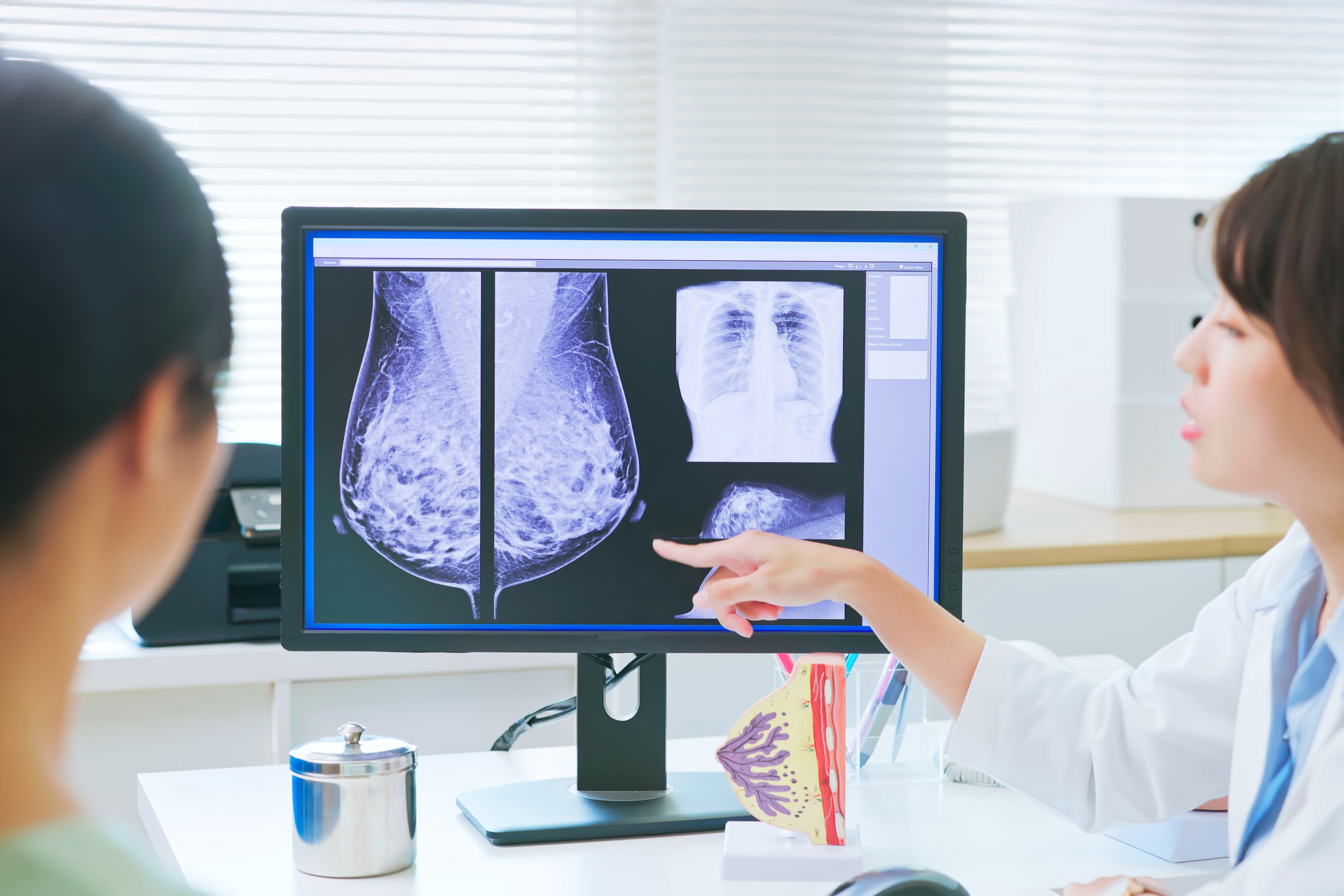Dense Breast Tissue: What Is It, Risks, Screening Options