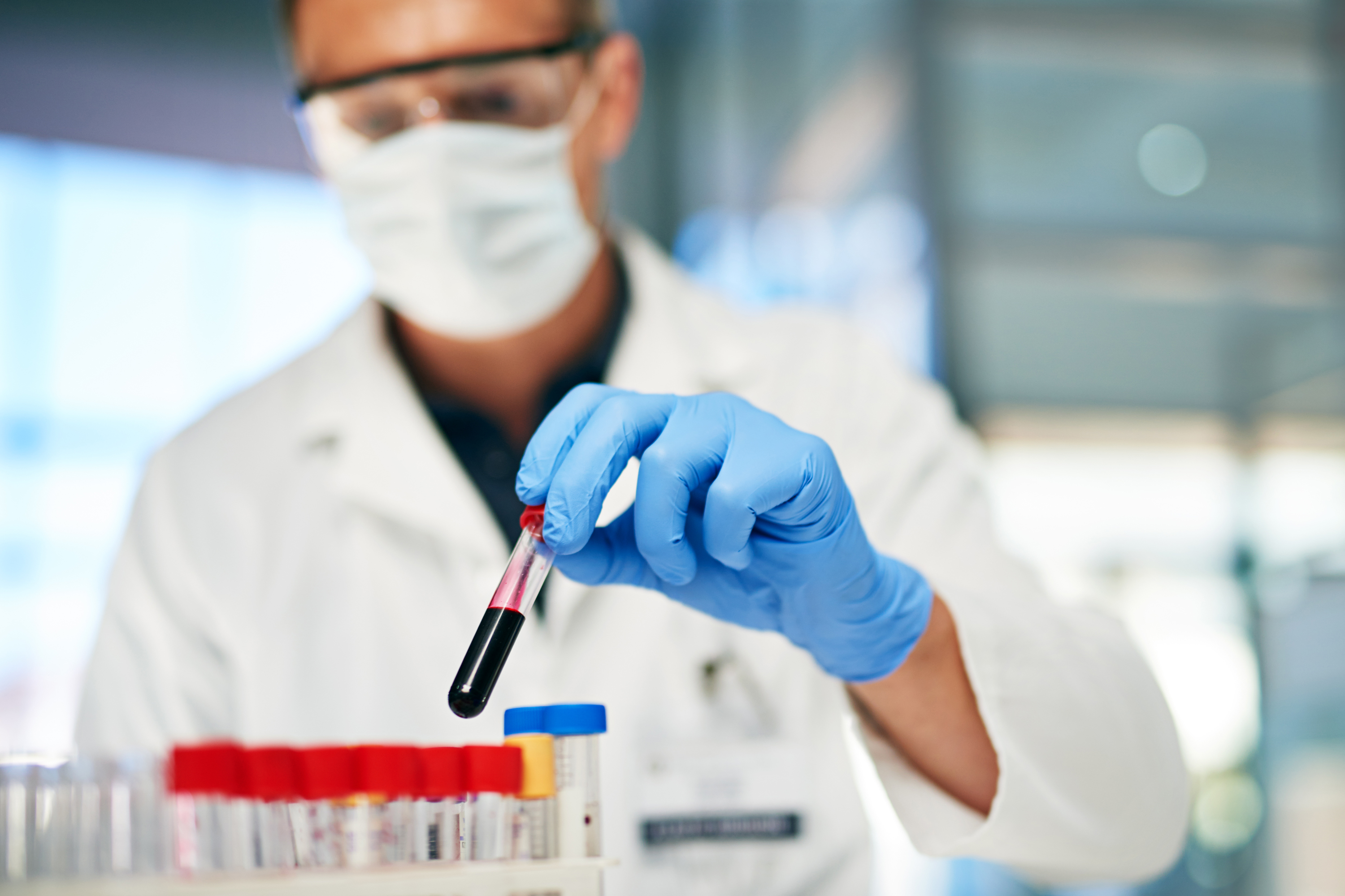 Immunoglobulin Free Light Chain Test: What Patients Should Know
