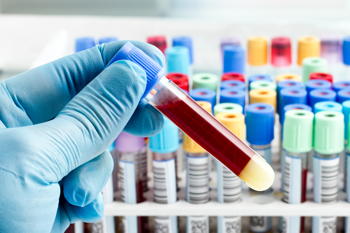 What Should CLL Patients Know About Their Blood Work?