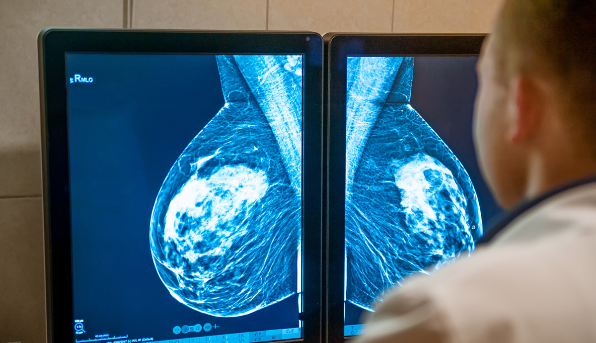 What Does a Cancerous Breast Lump Feel Like? What Does a Cancerous Breast Lump Feel Like?
