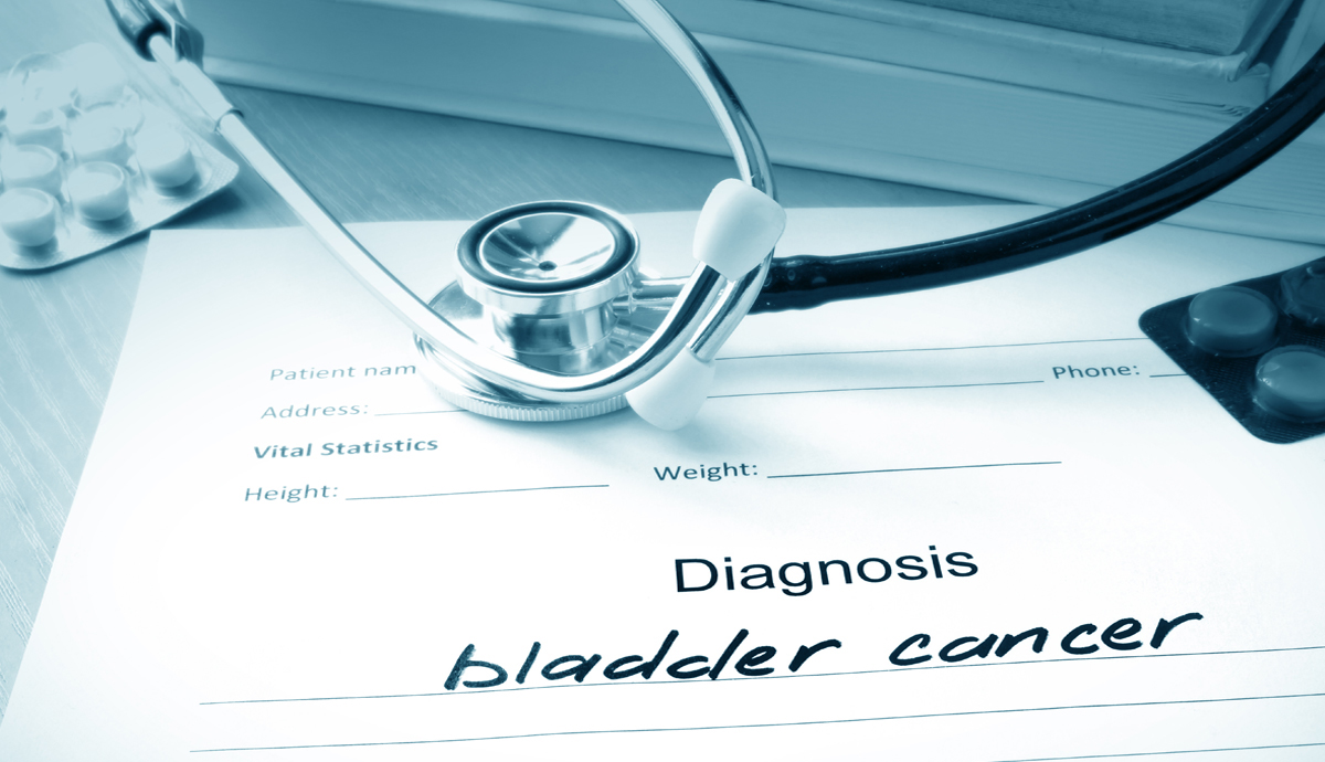 Bladder Cancer Stages and Grades Explained