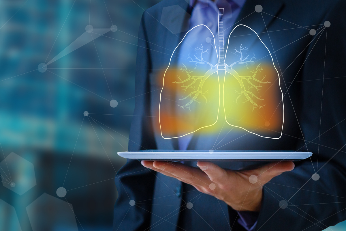 Can Artificial Intelligence Predict Lung Cancer Outcomes? Can Artificial Intelligence Predict Lung Cancer Outcomes?