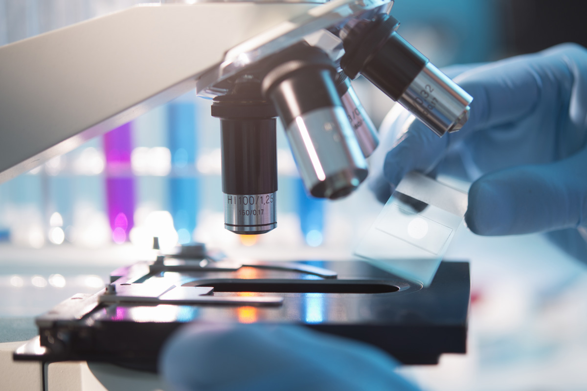Understanding Polycythemia Vera Lab Values