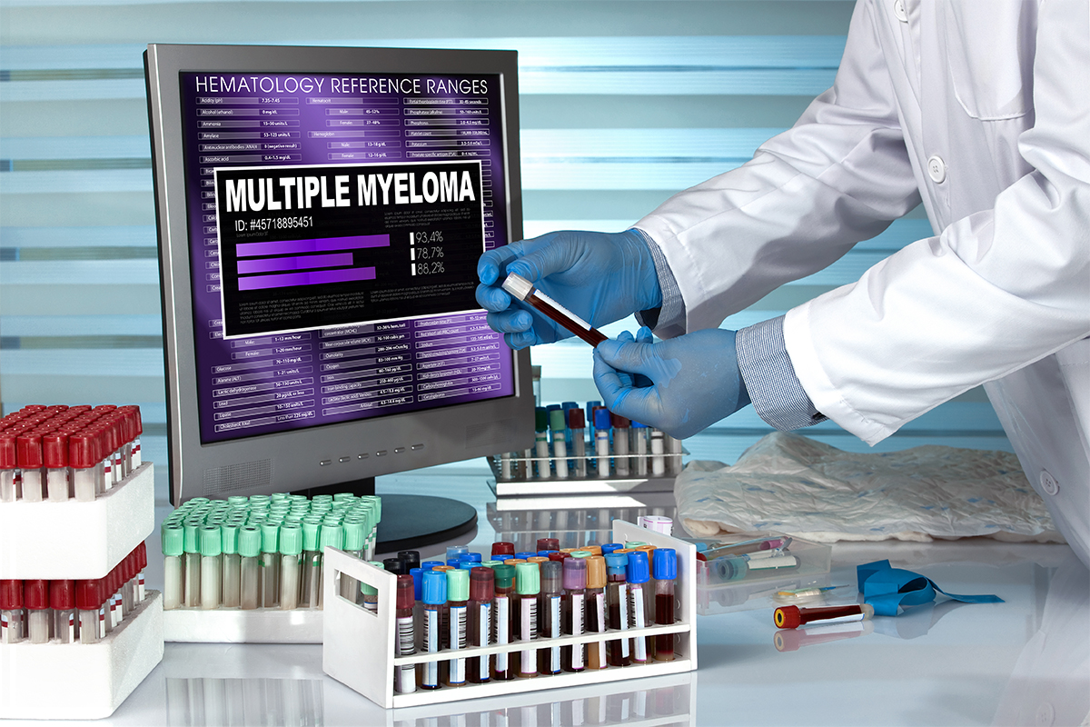 New Drug Combinations for Treating Multiple Myeloma