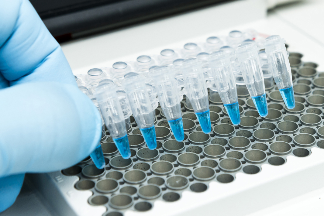 how-mrd-testing-can-affect-treatment-choice