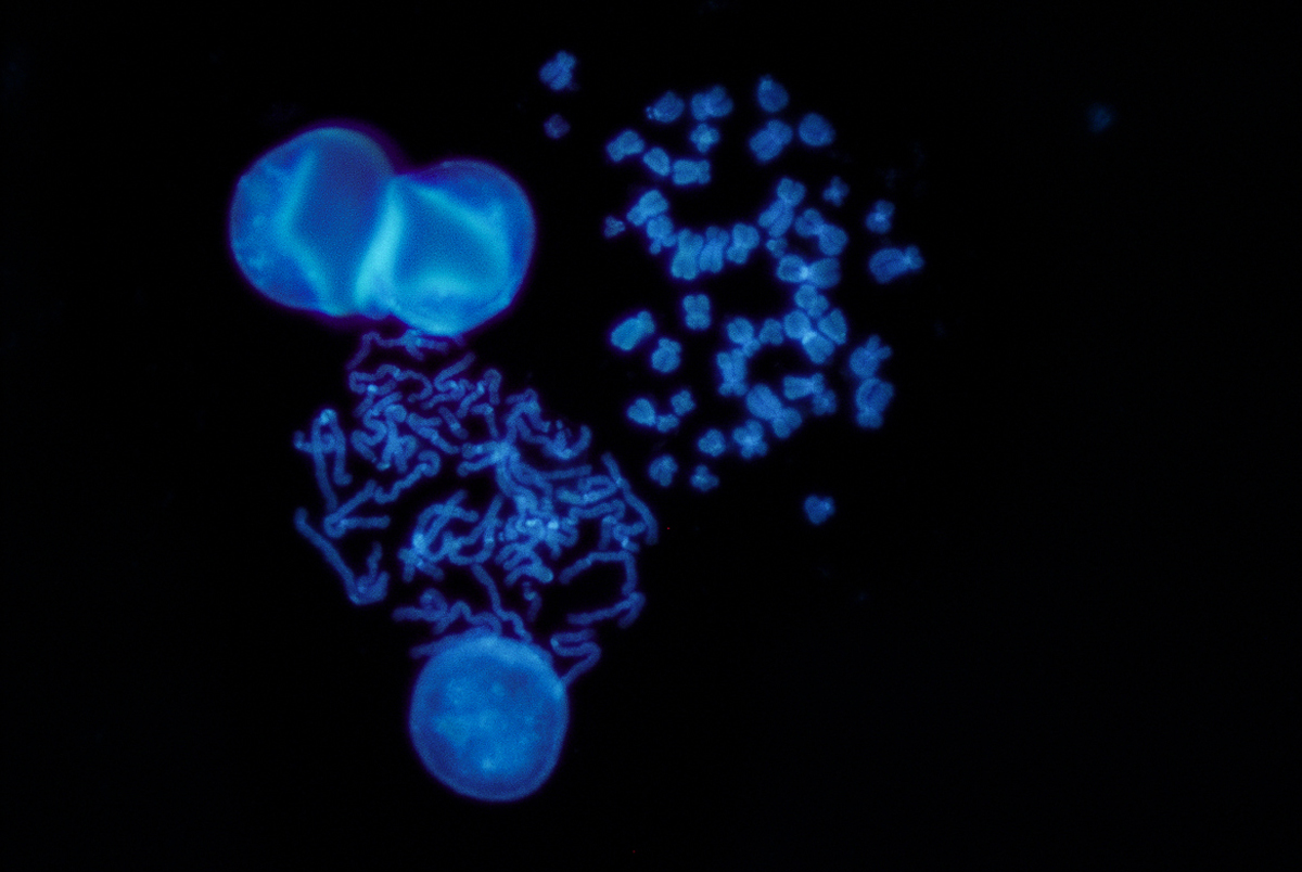 Understanding Fluorescent In Situ Hybridization (FISH) Test Results