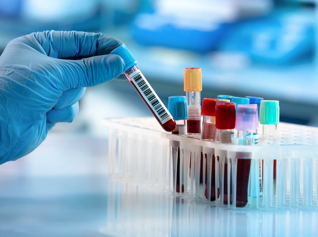 Experts Answer Important Questions on CLL Testing