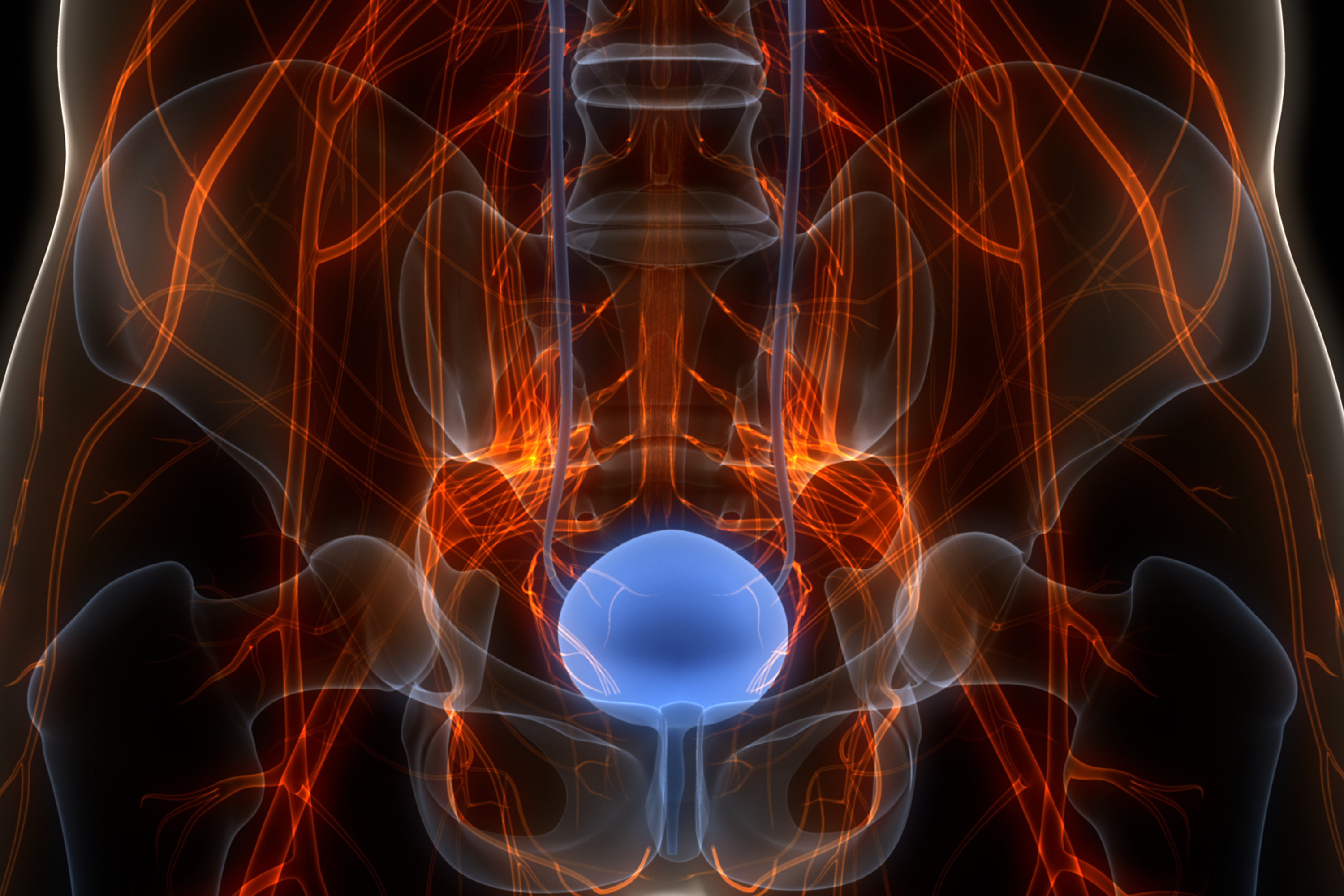 Understanding Bladder Cancer