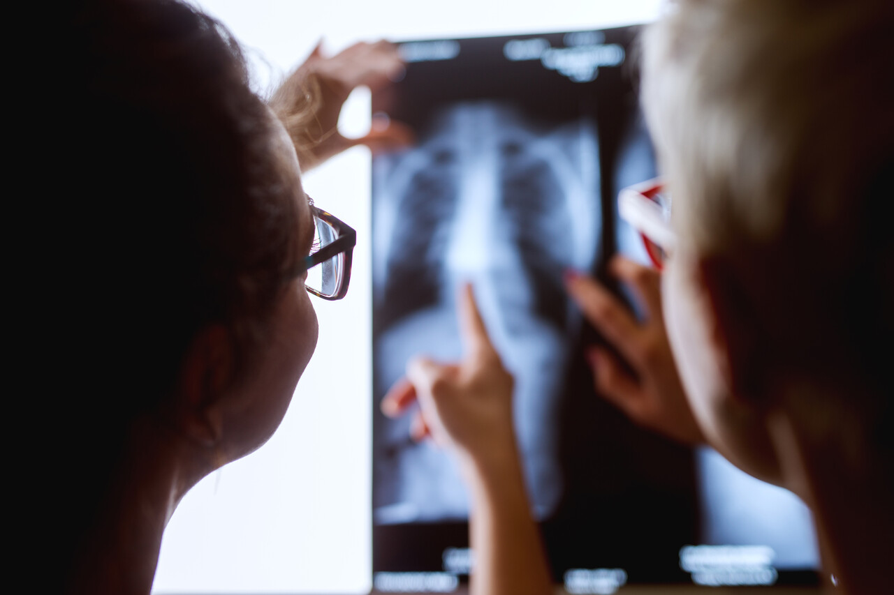 What is a Second Primary Cancer?