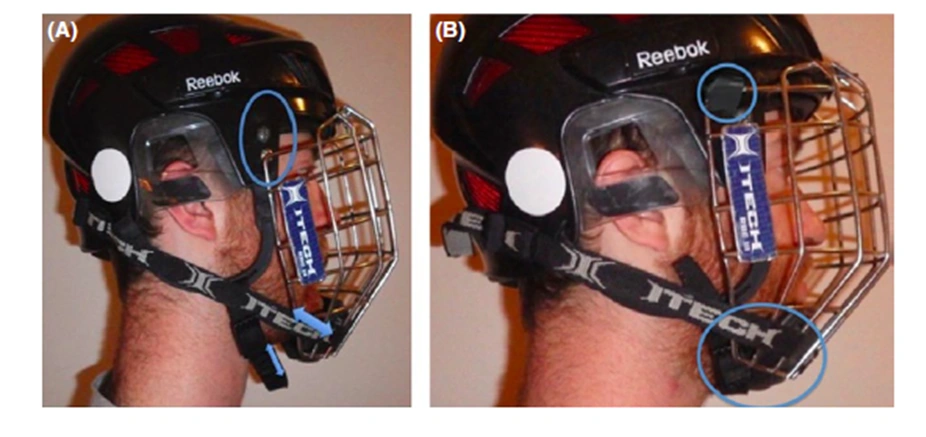 Face Shields | Sports dentistry - Education and Prevention: Play it ...