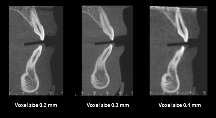 Voxel - Cone-Beam Computed Tomography (CBCT) Applications in Dentistry ...